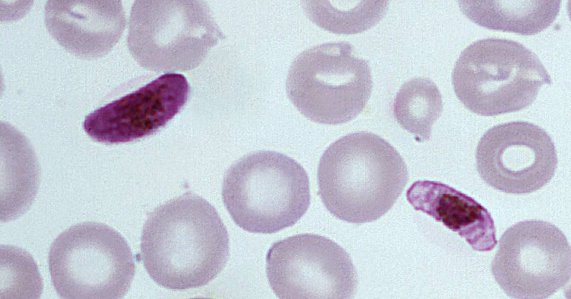 Une molécule du Nord contre la malaria - Faculté des sciences et de ...